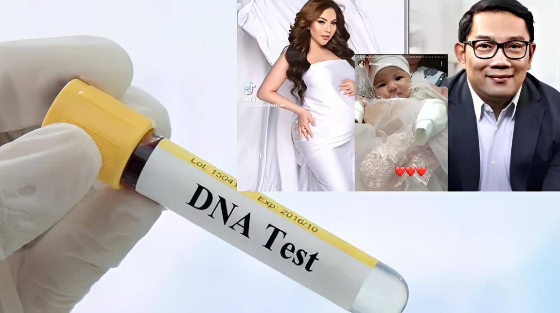 Tes DNA Bikin Geger! Ridwan Kamil Resmi Bukan Ayah Anak Lisa Mariana